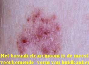 KOSMOGRAFIE (OPLOSSEN VAN EEN KRUISWOORDRAADSEL)